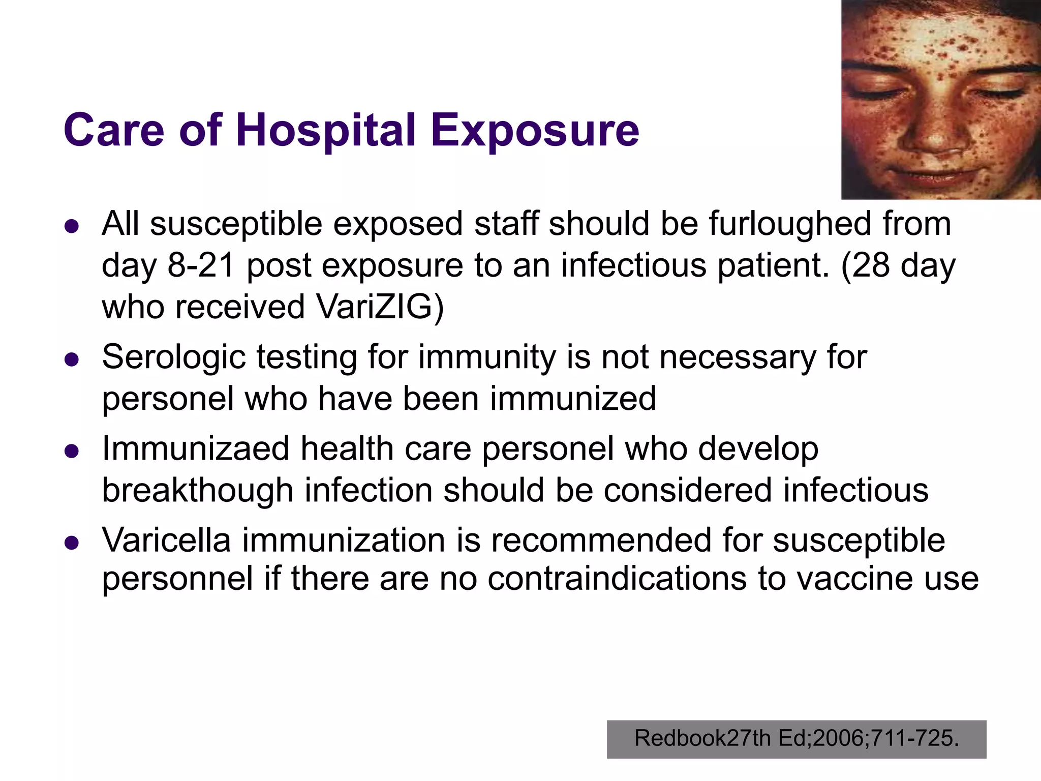 Varicella zoster virus | PDF