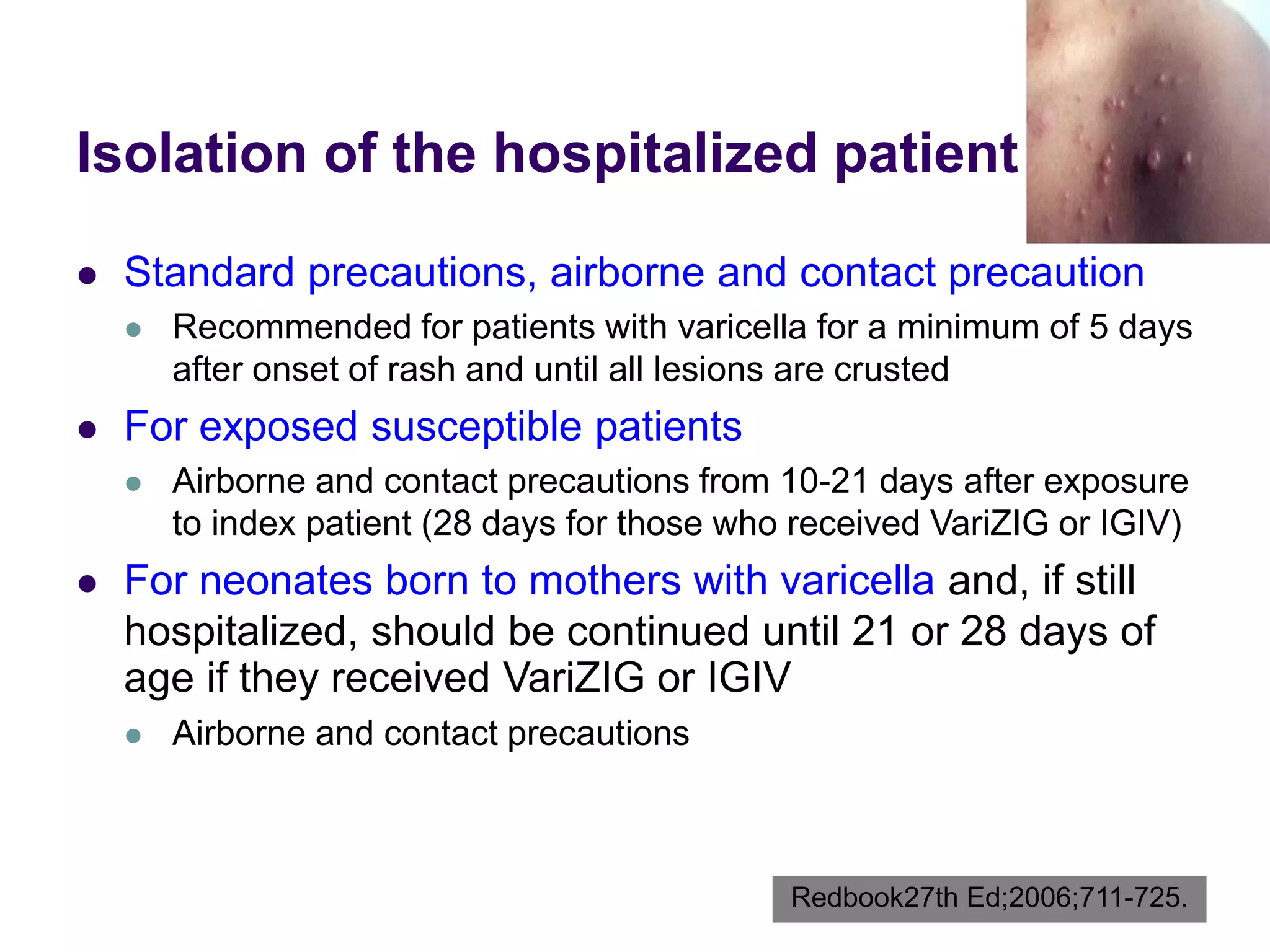 Varicella zoster virus | PDF