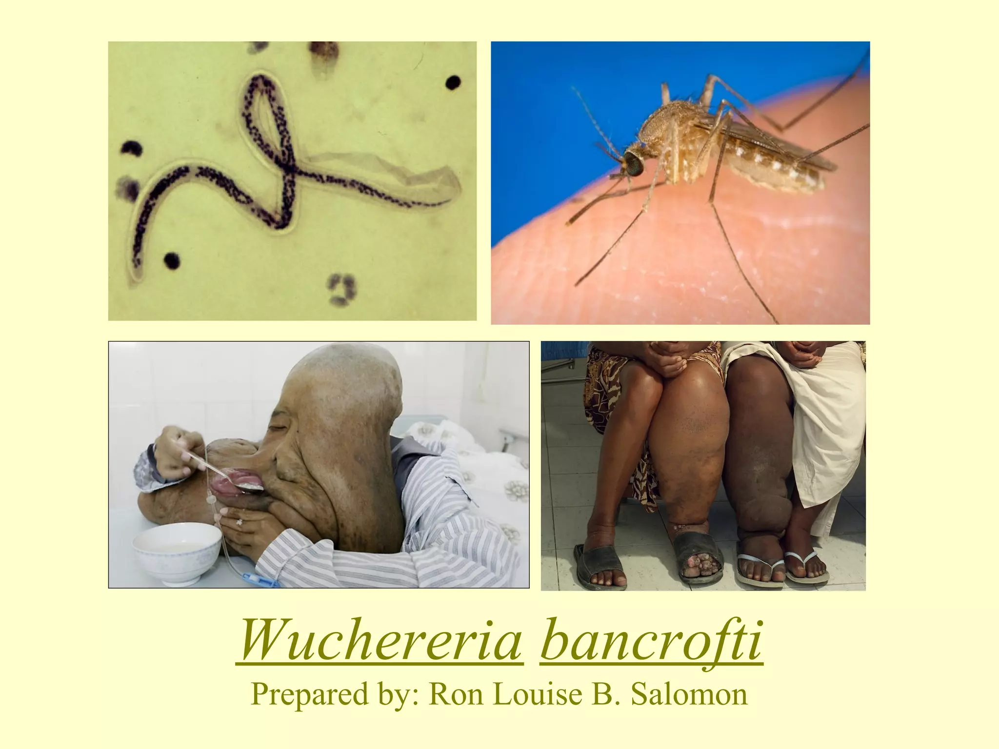 Wuchereria bancrofti | PPT
