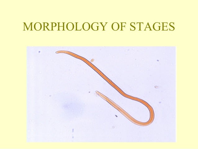 Wuchereria bancrofti