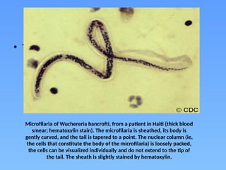 W. bancrofti. MLT GROUP Presentation.pptx