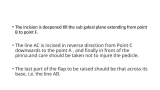 Washio flap for external nose defects tubee flap | PPTX