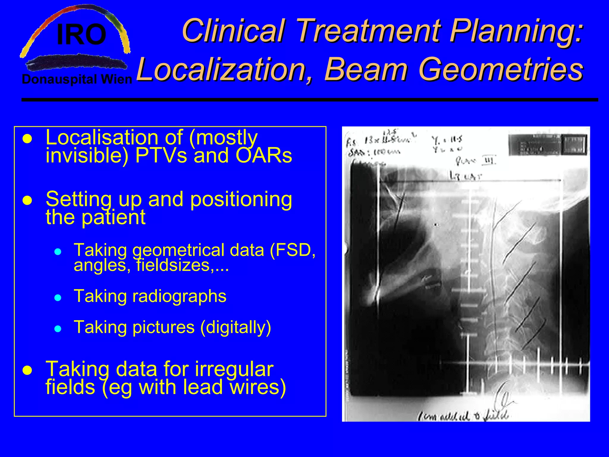 planning systems in radiotherapy | PDF