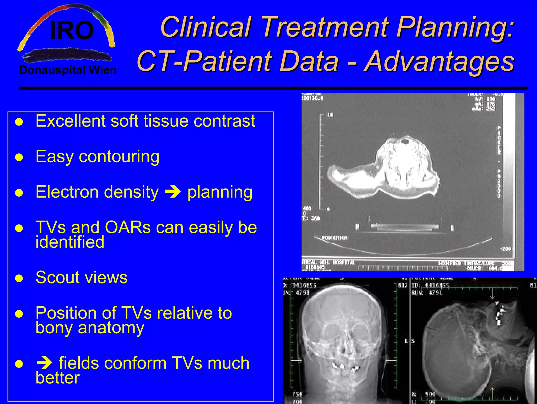 planning systems in radiotherapy | PDF