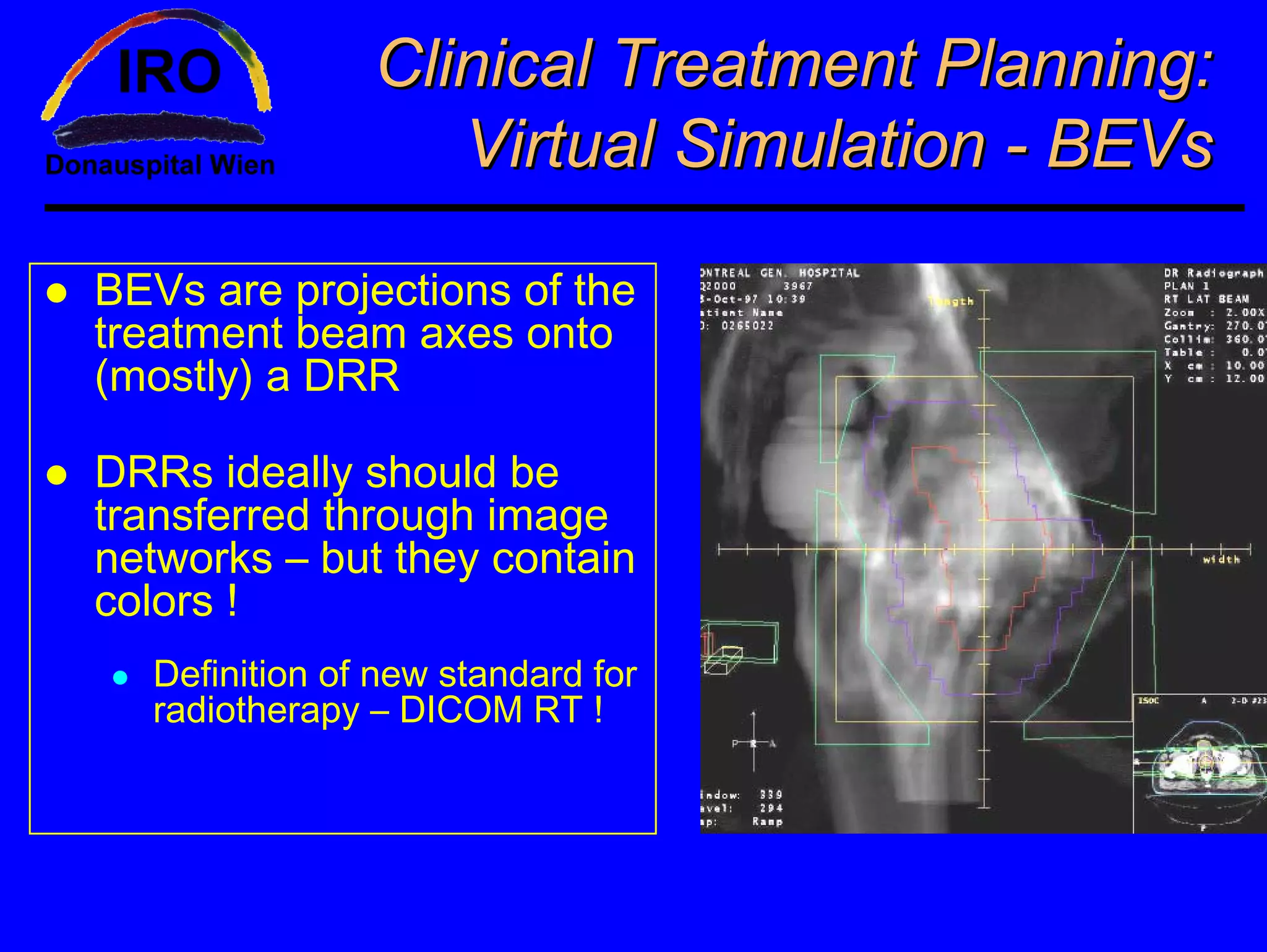 planning systems in radiotherapy | PDF