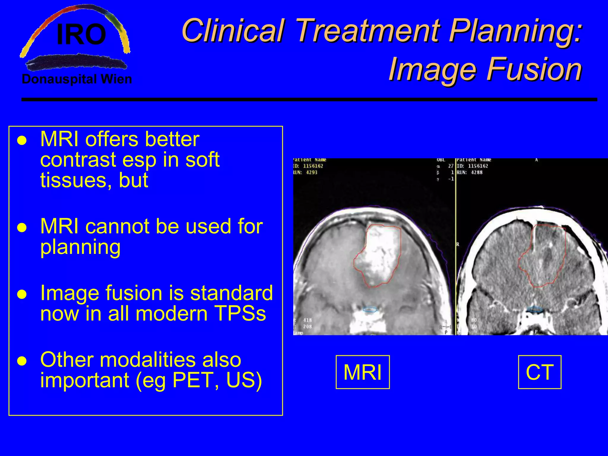 planning systems in radiotherapy | PDF