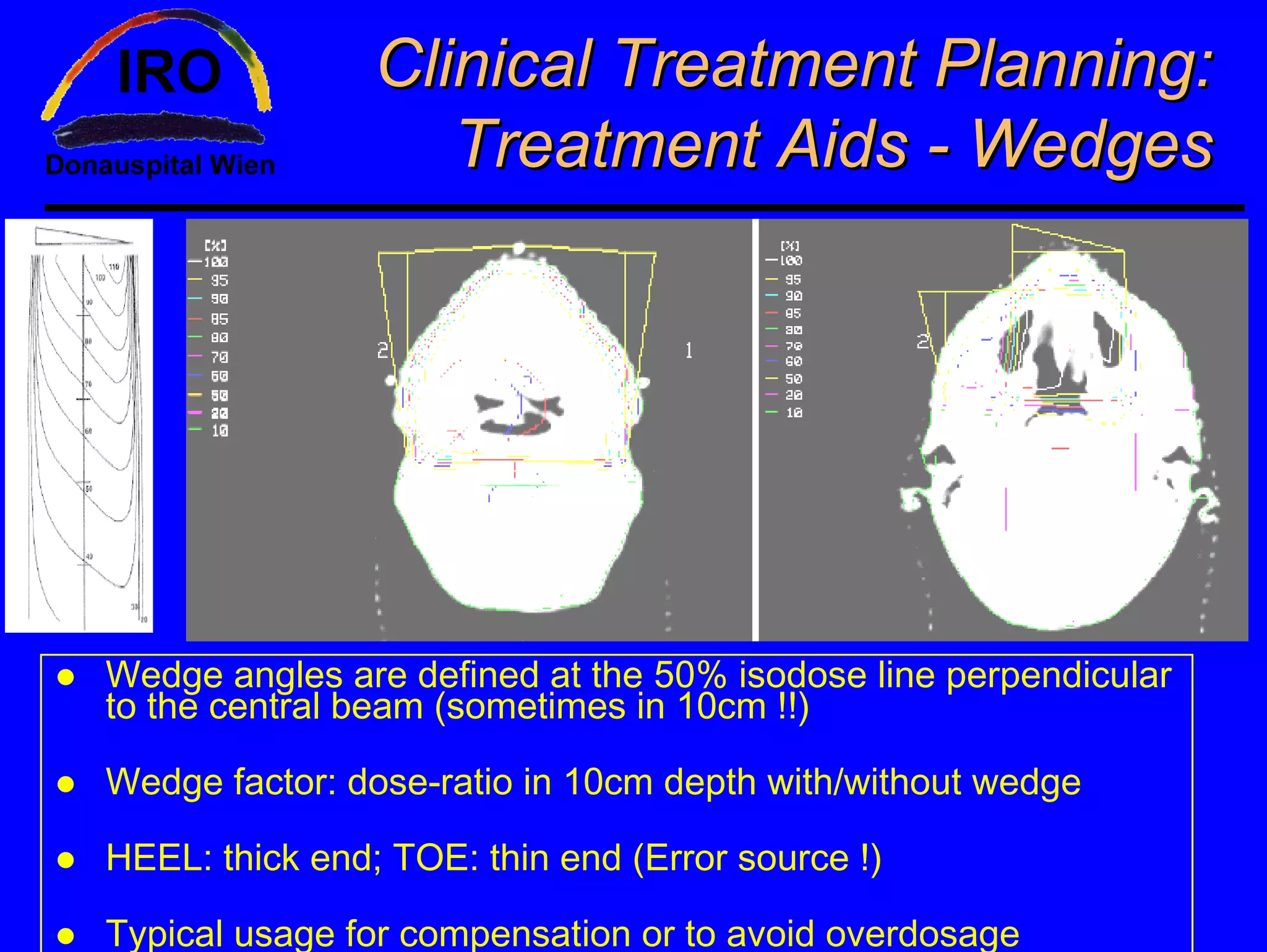 planning systems in radiotherapy | PDF