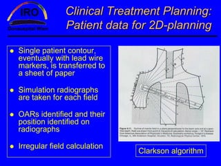 planning systems in radiotherapy | PDF