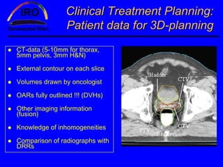 planning systems in radiotherapy | PDF