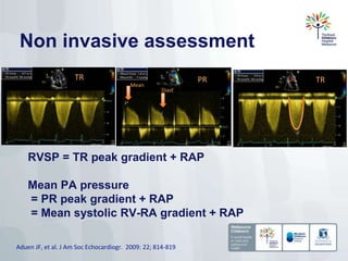 Pulmonary hypertension and ICU therapies by Dr Bennett Sheridan | PPTX