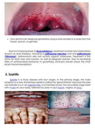 SCIENCE 10 DISEASES AND DISORDER OF RP.pdf