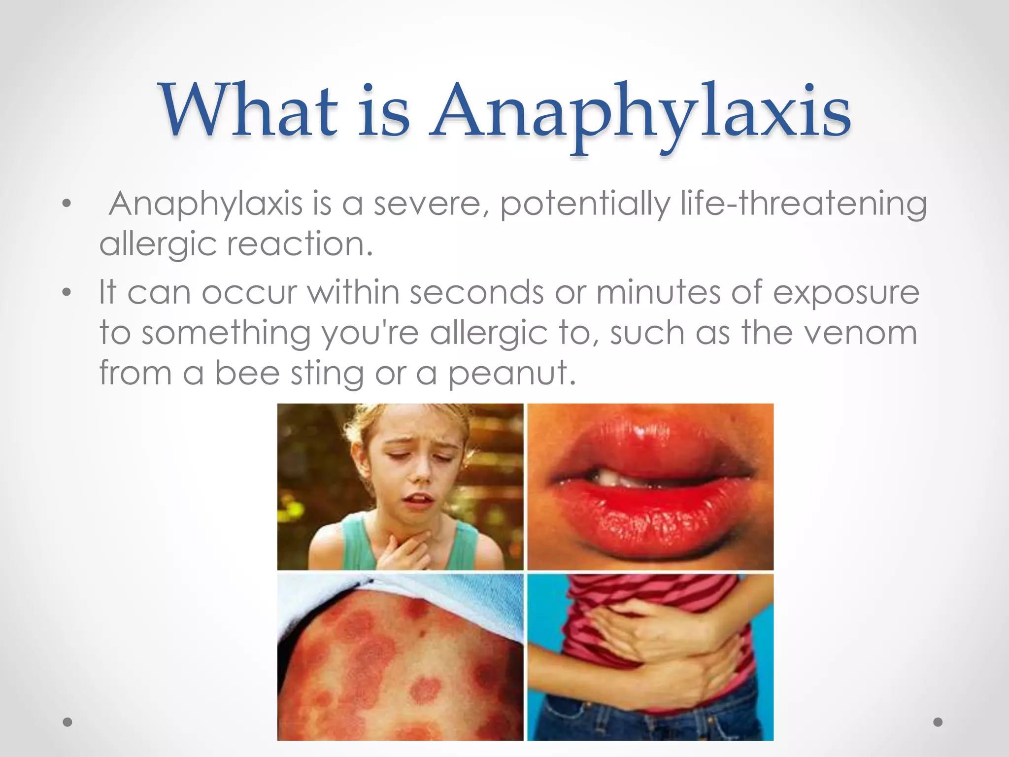 Anaphylaxis | PPTX