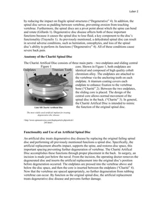 Spinal Disc Implants | DOC | Bone and Joint Conditions | Diseases and ...