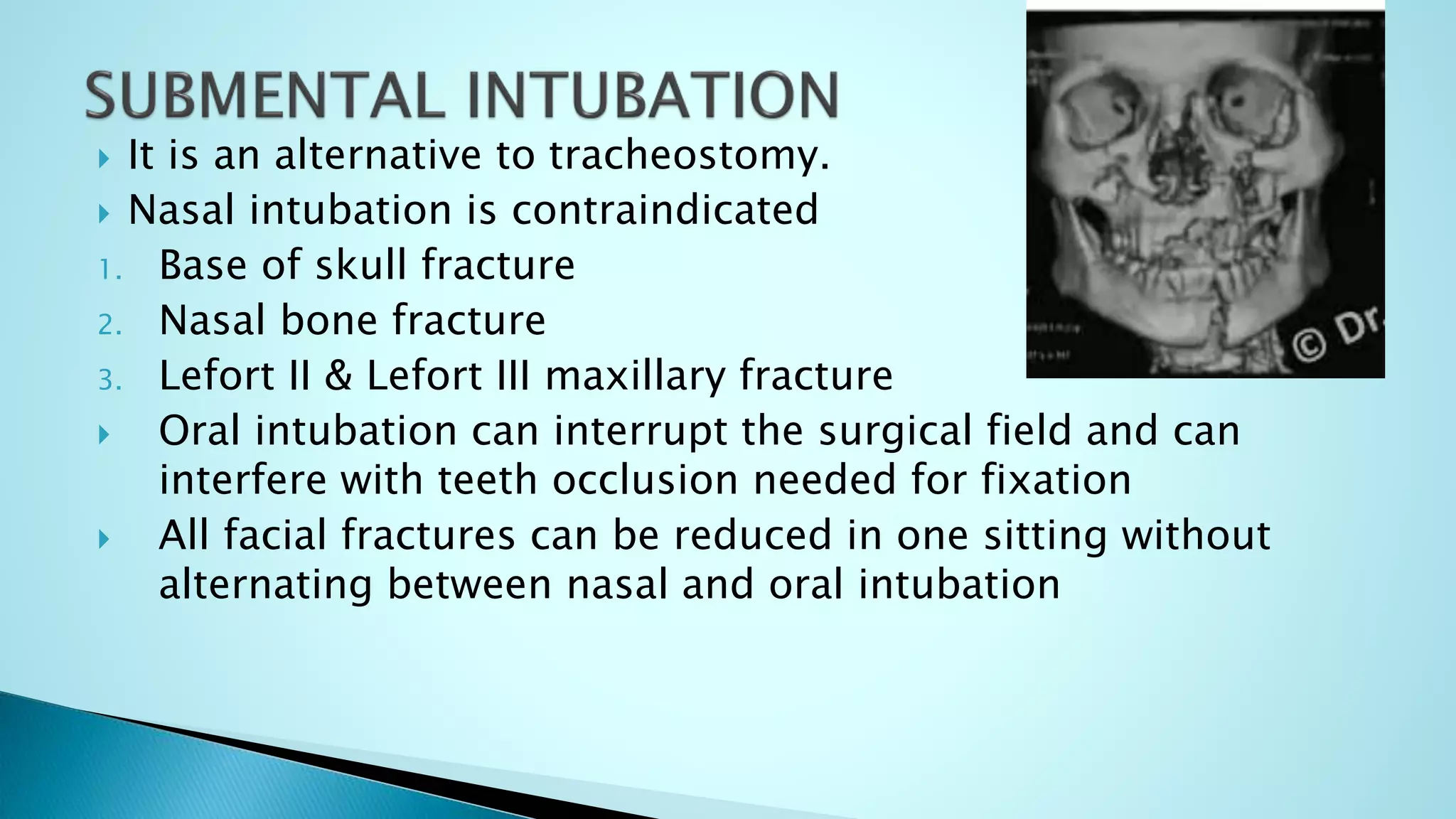 SUBMENTAL INTUBATION.pptx