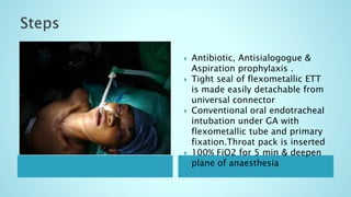 SUBMENTAL INTUBATION.pptx