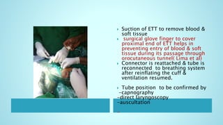 SUBMENTAL INTUBATION.pptx