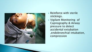 SUBMENTAL INTUBATION.pptx