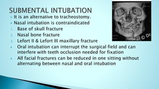 SUBMENTAL INTUBATION.pptx