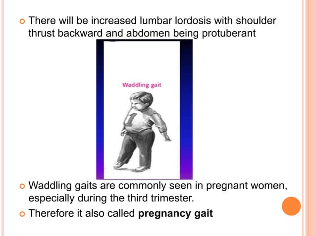 Waddling gait- definition|role of muscle|gait analysis|kinematic and ...