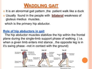 Waddling Gait