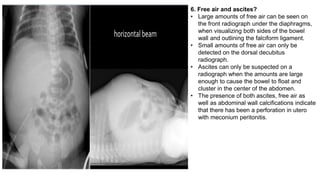 role of radiology in pediatric.pptx