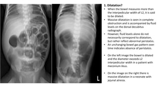 role of radiology in pediatric.pptx