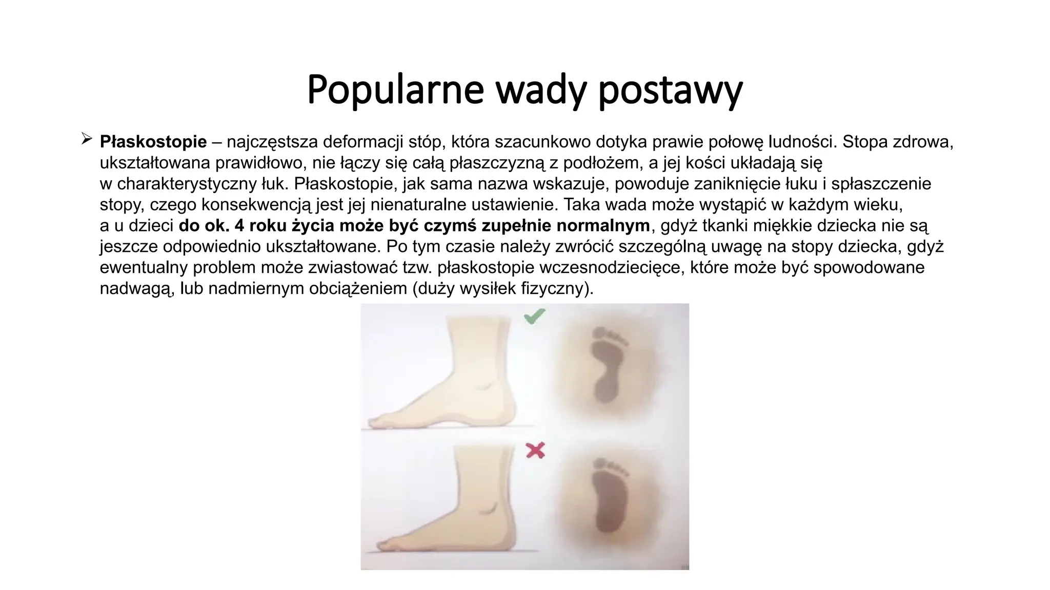 Wady postawy w wieku przedszkolnym.pptx
