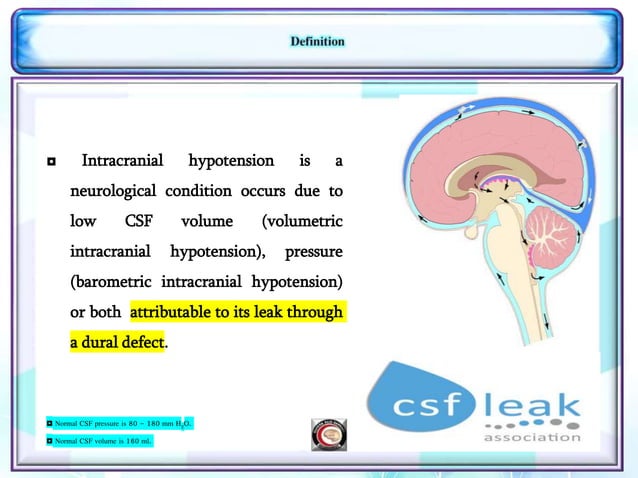 Spontaneous intracranial hypotension | PPT