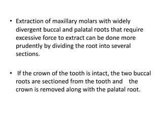 complicated exodontia presented by htet myat aung | PPT