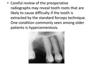 complicated exodontia presented by htet myat aung | PPT