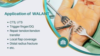 Wide Awake Local Anesthesia No Tourniquet in Orthopaedic Surgery | PDF