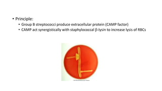 wala strep.pptx | Ear, Nose and Throat Conditions | Diseases and Conditions