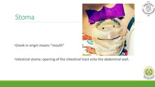 Colostomy & Ileostomy | PDF