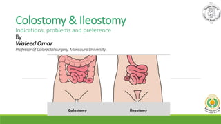 Ileostomy Vs Colostomy