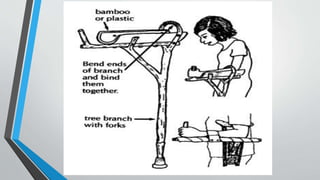 PHYSIOTHERAPY JUNOON Dr. Vinita Walking aids | PPT