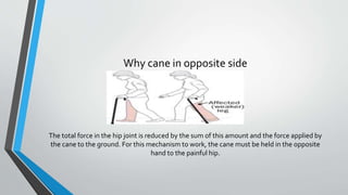 PHYSIOTHERAPY JUNOON Dr. Vinita Walking aids | PPT