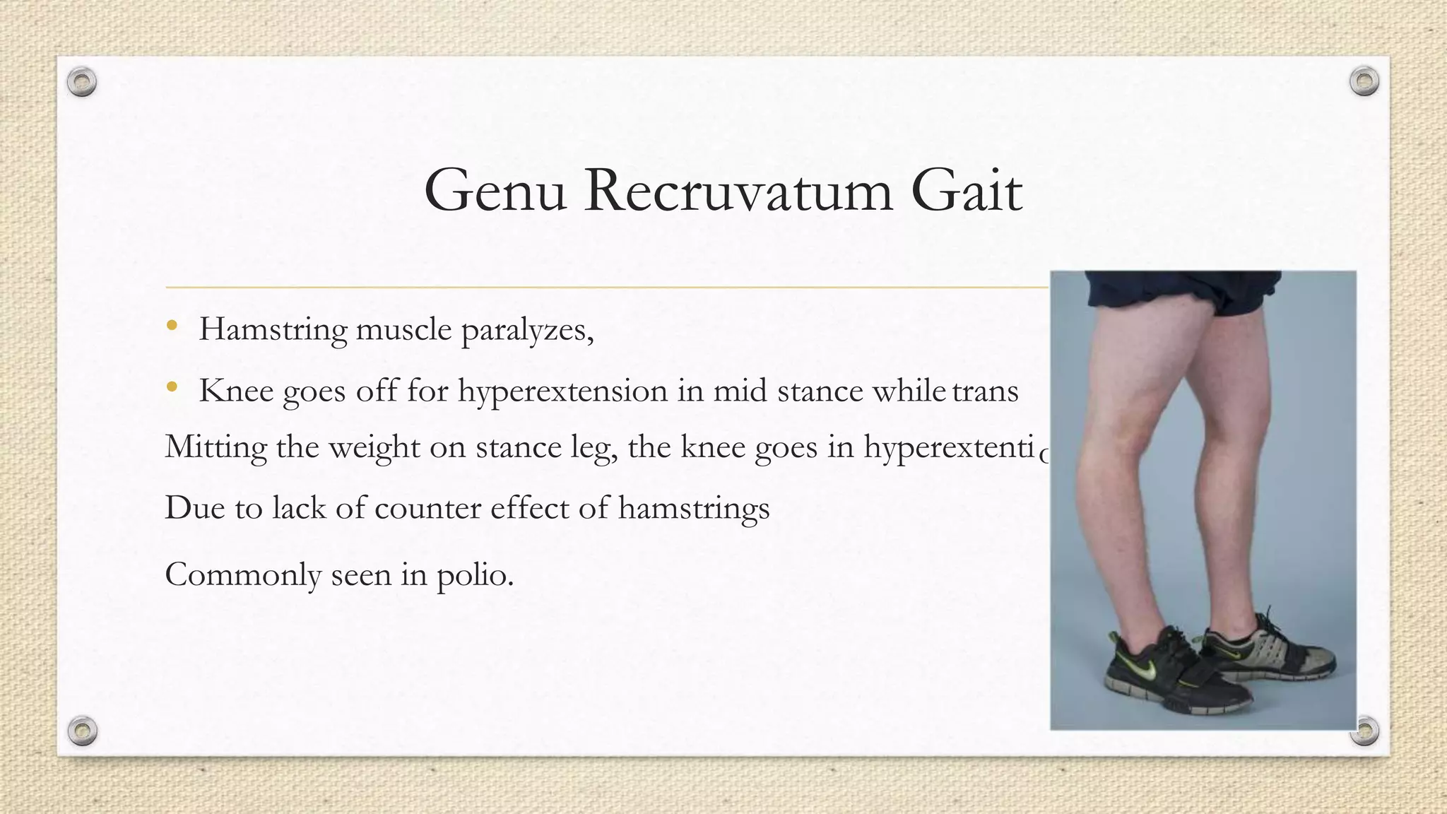 Walking Gait abnormalities.pptx