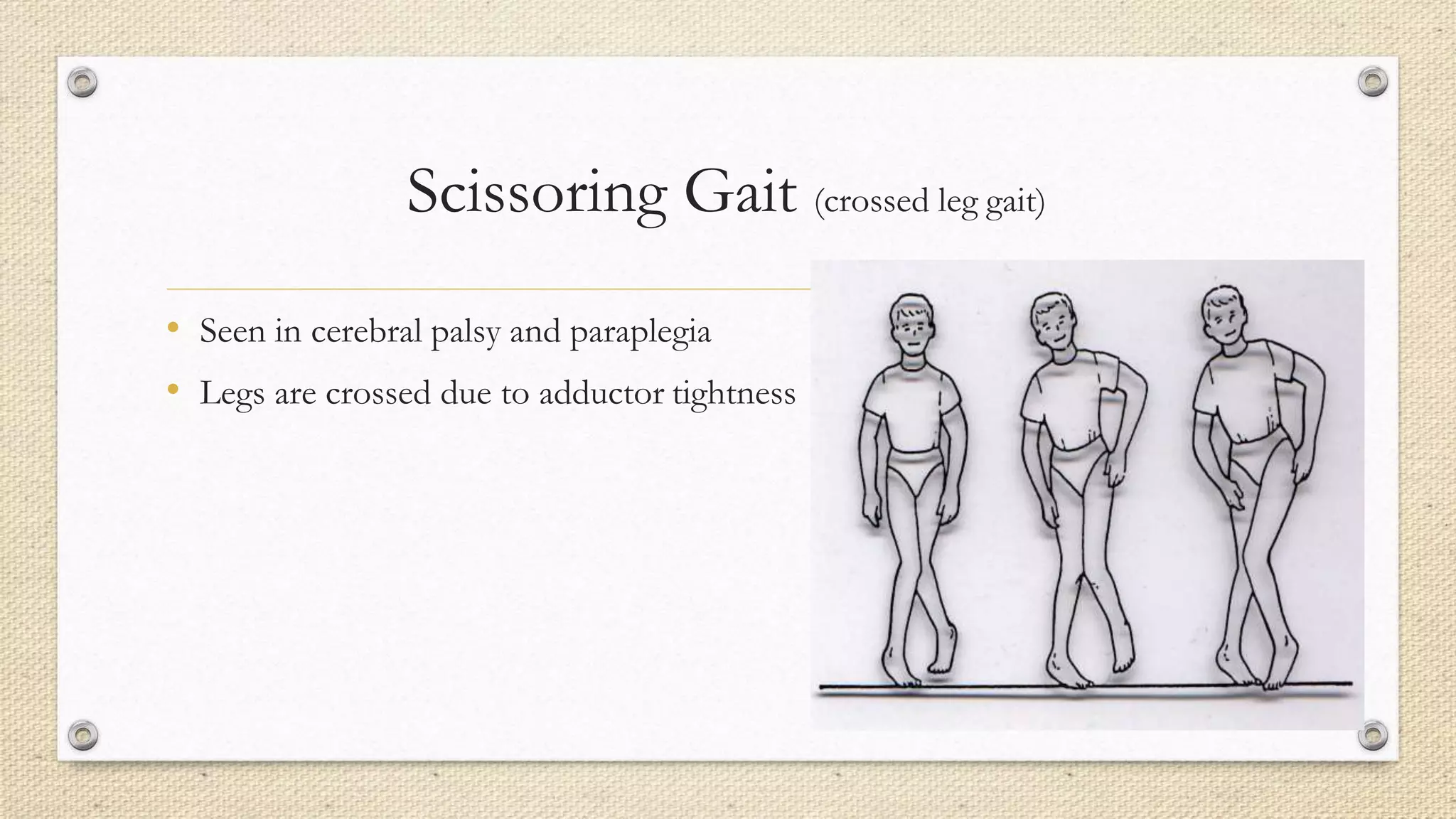 Walking Gait abnormalities.pptx