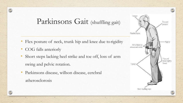 Walking Gait abnormalities.pptx