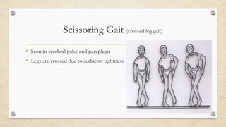 Walking Gait abnormalities.pptx