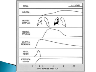 Wallgren timetable of primary tb | PPTX