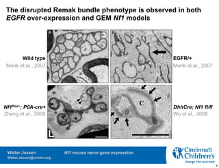 Nerve gene expression patterning in Nf1 mouse models | PDF | Brain and ...