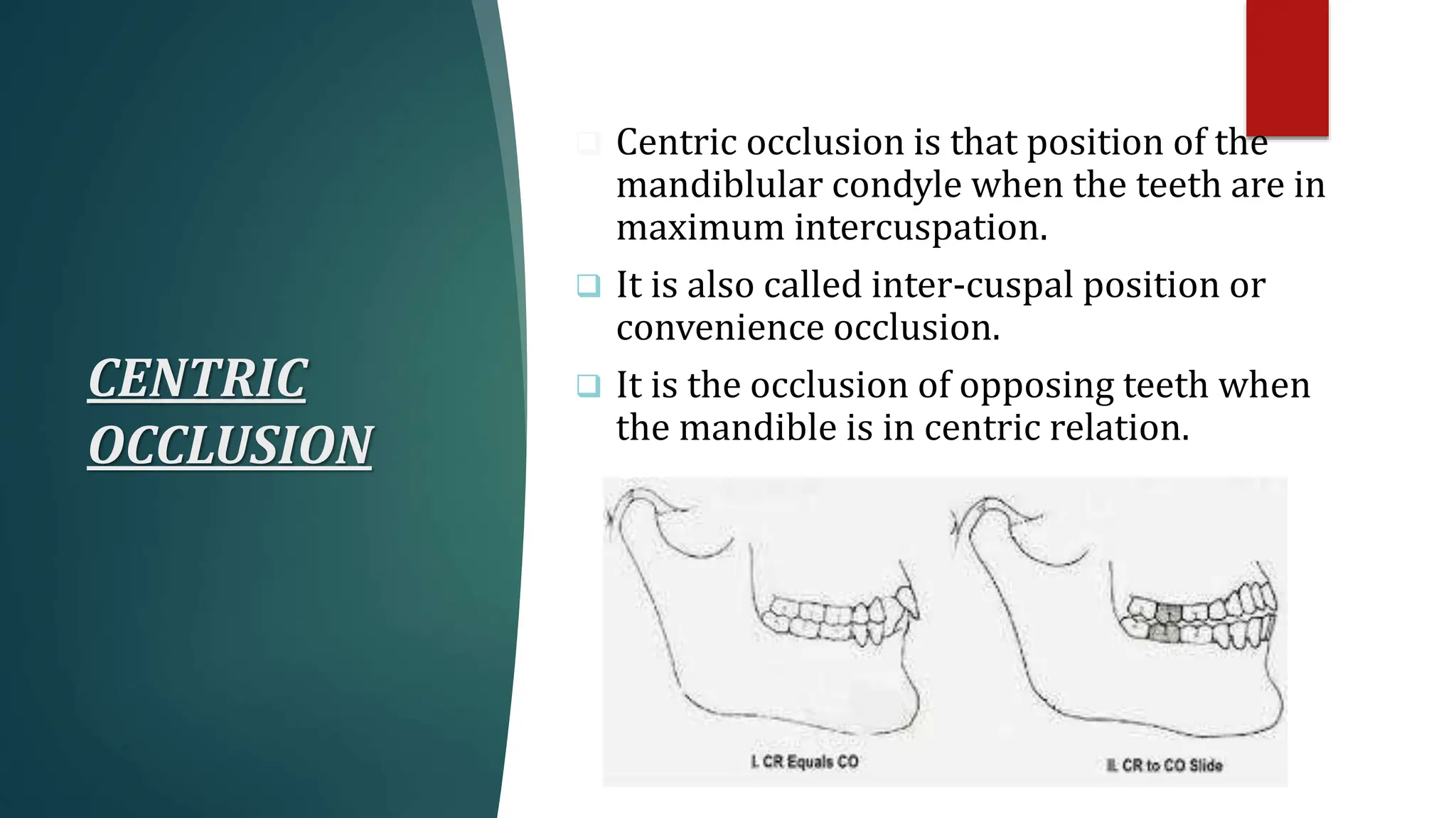 Dentistry pptx on topic of normal occlusion | PPT