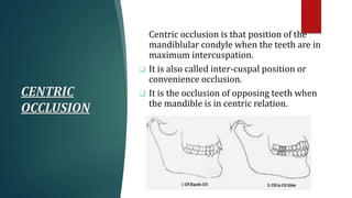 Dentistry pptx on topic of normal occlusion | PPT