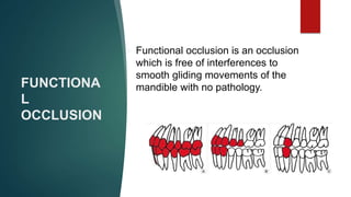 Dentistry pptx on topic of normal occlusion | PPT