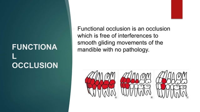 Dentistry pptx on topic of normal occlusion | PPT