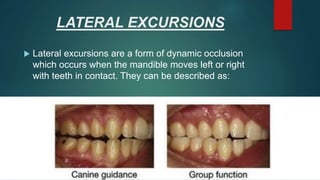 Dentistry pptx on topic of normal occlusion | PPT