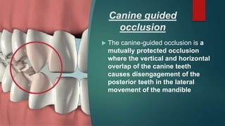 Dentistry pptx on topic of normal occlusion | PPT