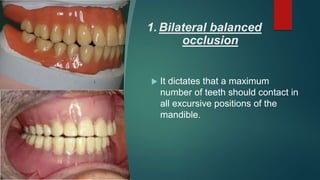 Dentistry pptx on topic of normal occlusion | PPT