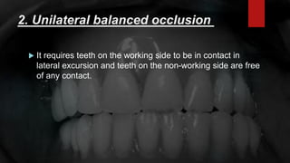 Dentistry pptx on topic of normal occlusion | PPT